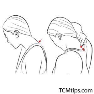 7 Acupressure Points For Fever That Work Every Time - Easy TCM Wisdom ...