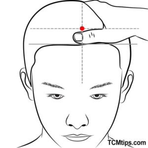 Discover 12 Effective Acupressure Points for Vertigo Relief