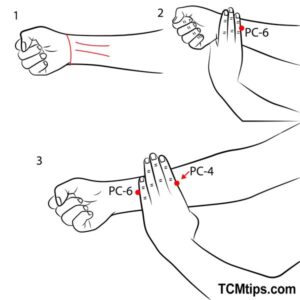Best 3 Acupressure Points For Heart Arrhythmia That You Need To Know ...
