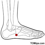 15 Acupressure Points for Bladder Issues: Quick Relief for Office ...