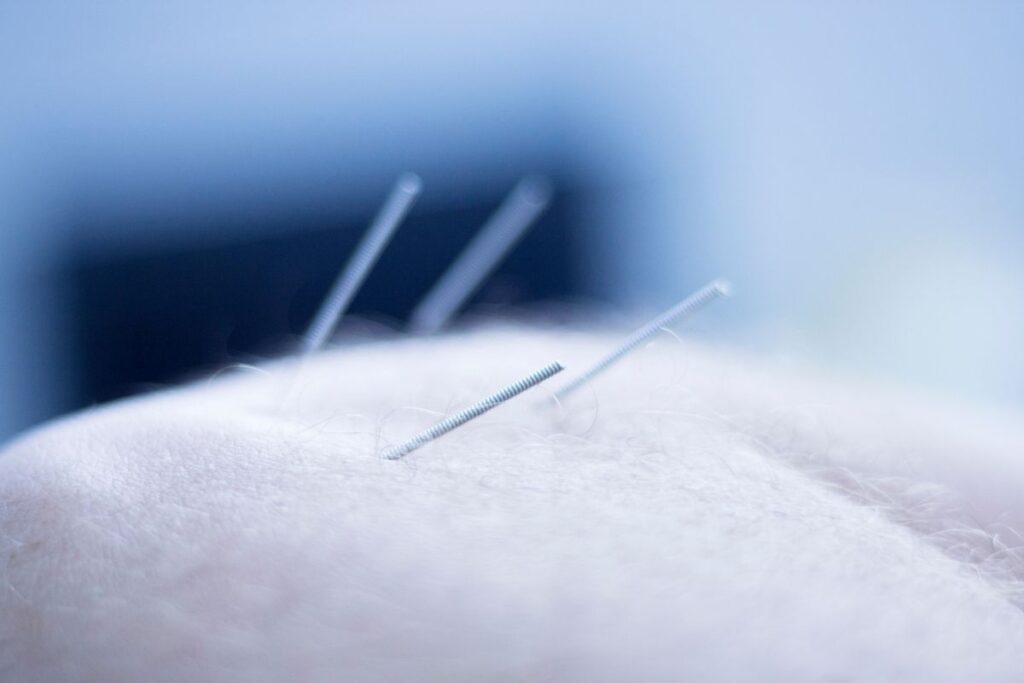 10 Best Acupuncture Clinics In Albany NY - Easy TCM Wisdom : Your Path ...